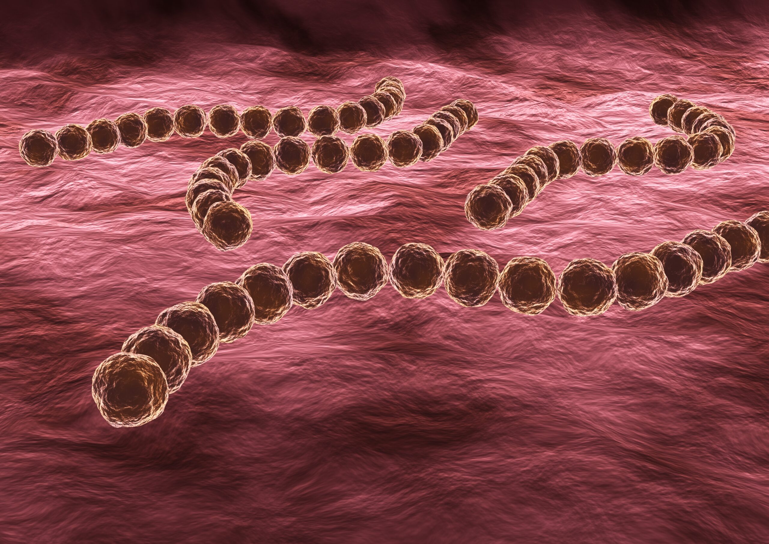 Scarlet Fever What Is Causes Symptoms And Treatment Scarlet Fever What Is Causes Symptoms And Treatment