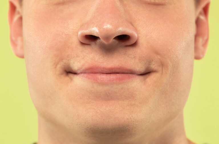 Deviated Septum: What Is, Causes, Symptoms, and Diagnosis