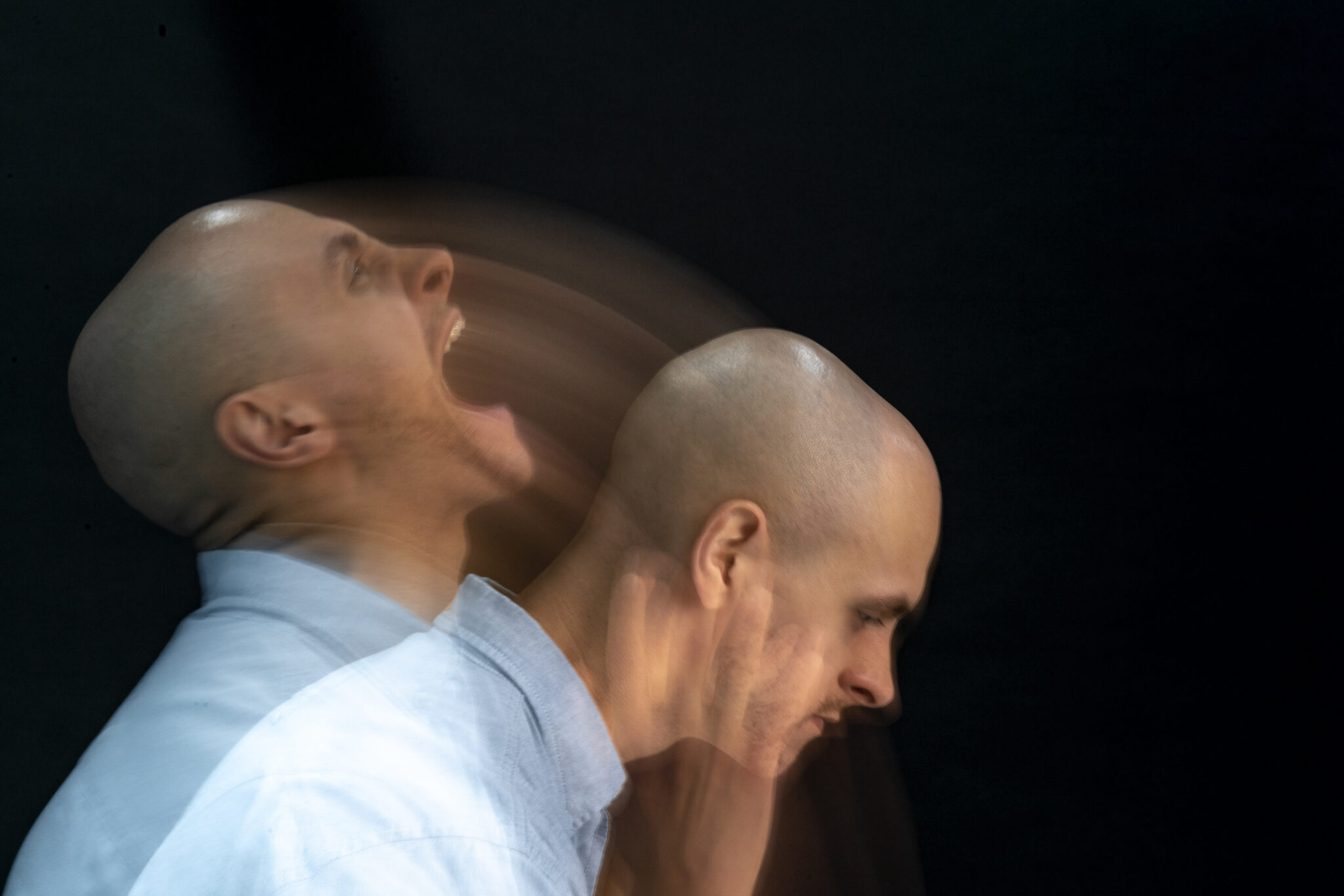Dissociative Identity Disorder: What Is, Symptoms, Causes, and Diagnosis