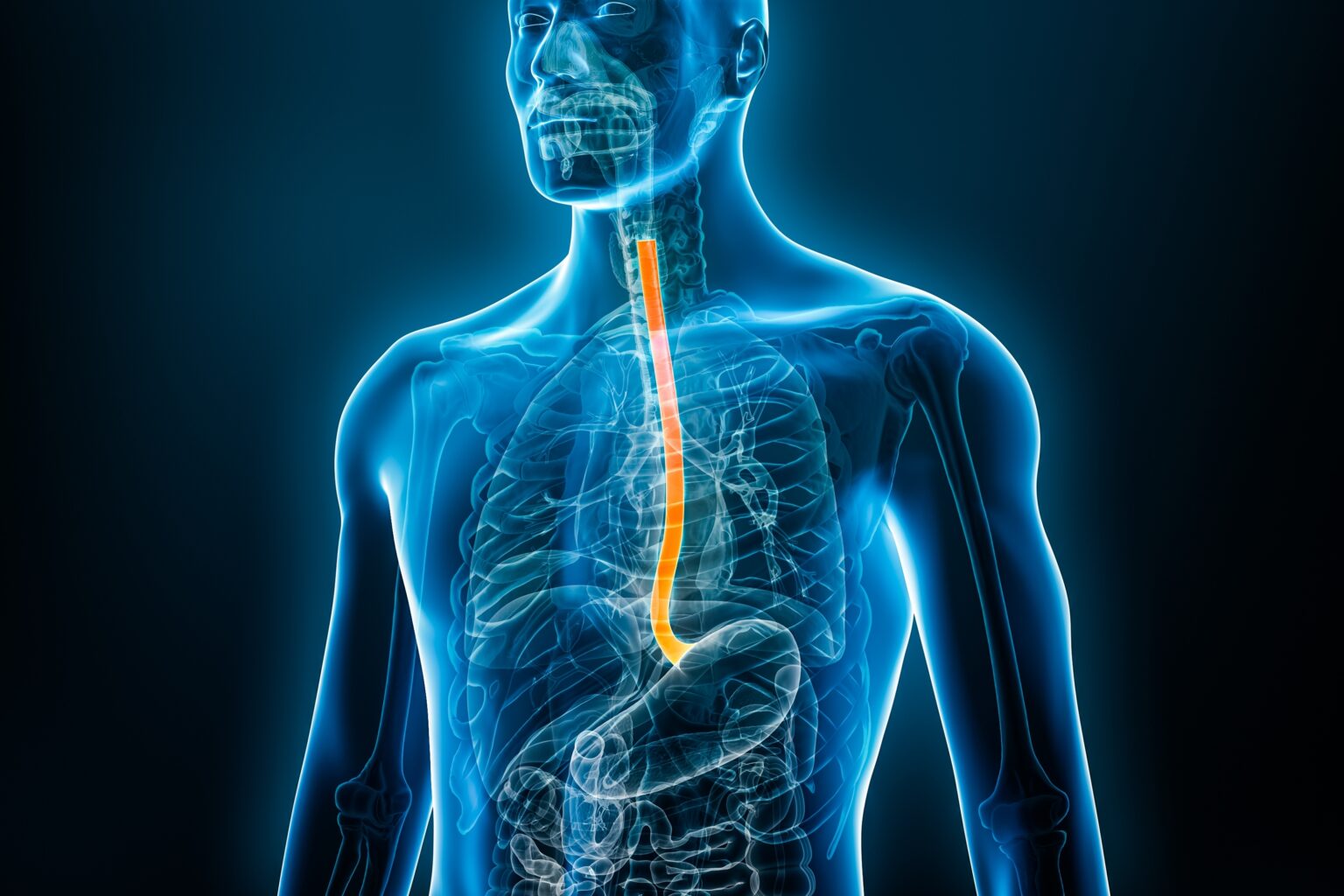 Esophagitis: What Is, Types, Symptoms, and Treatment