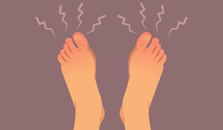 Candida: What Is, Tests, and Treatment