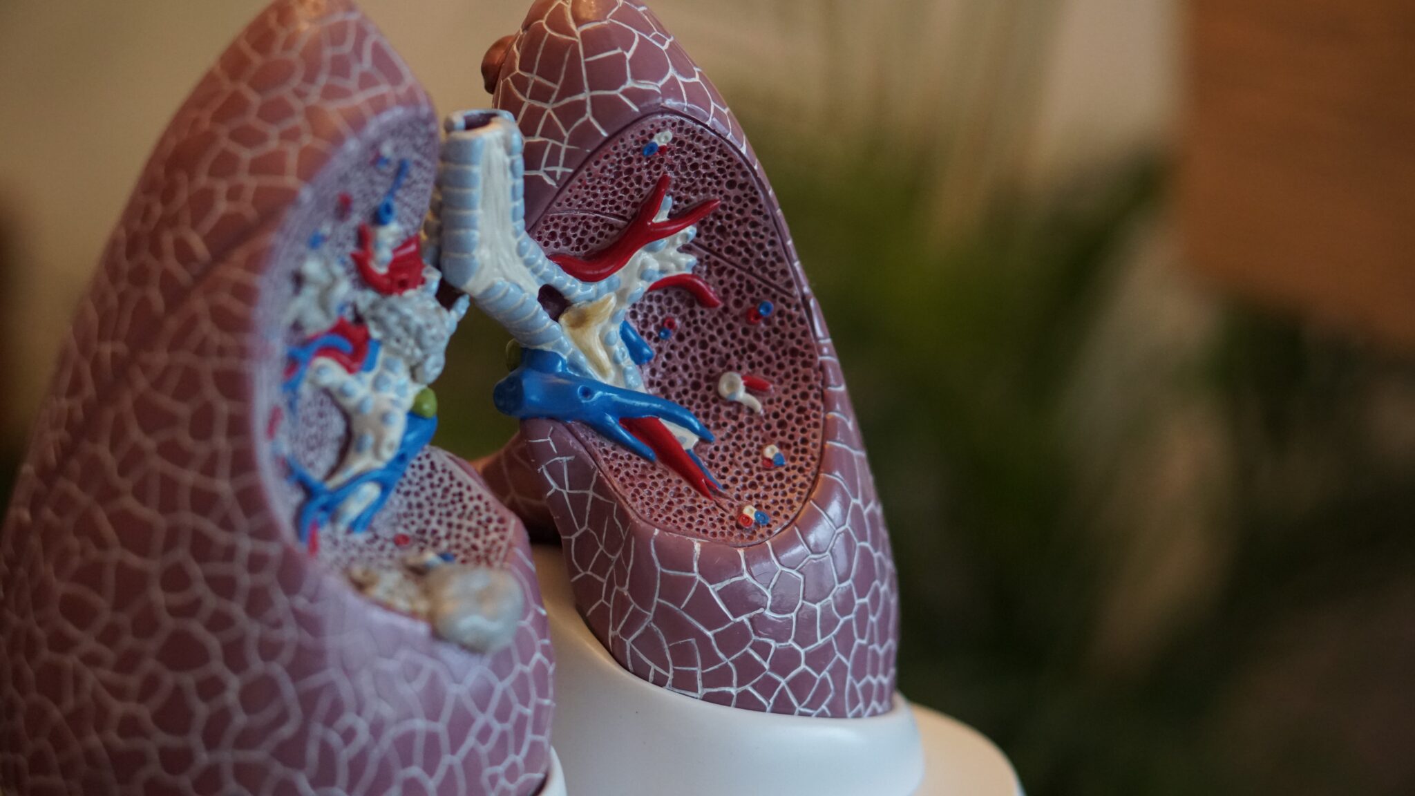 Hypercapnia: What Is, Risks, Causes, Levels, and Symptoms