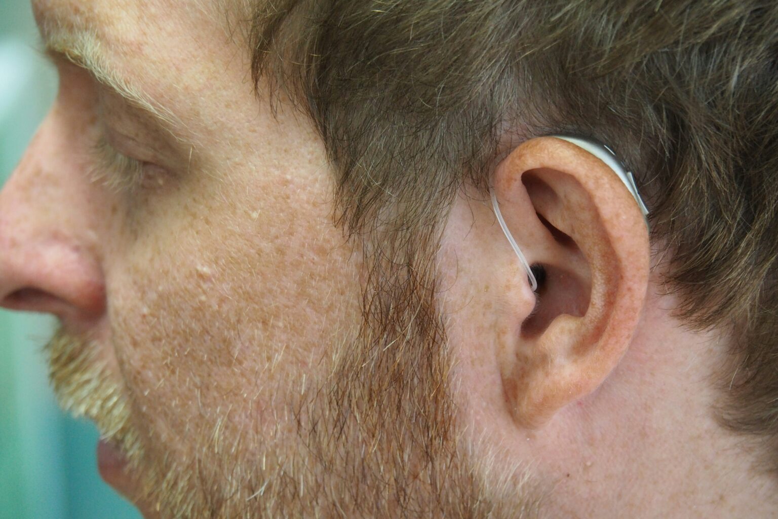 Ear Infection: What Is, Types, Causes, Symptoms, Diagnosis and Treatment