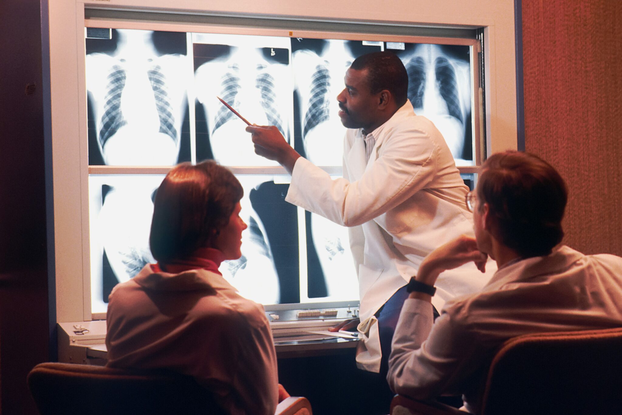 Spondylosis: What Is, Causes, Types, Symptoms, and Diagnosis