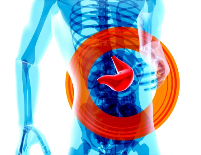 Bile: What Is, How It Works, Conditions, Risk Factors, and Treatment
