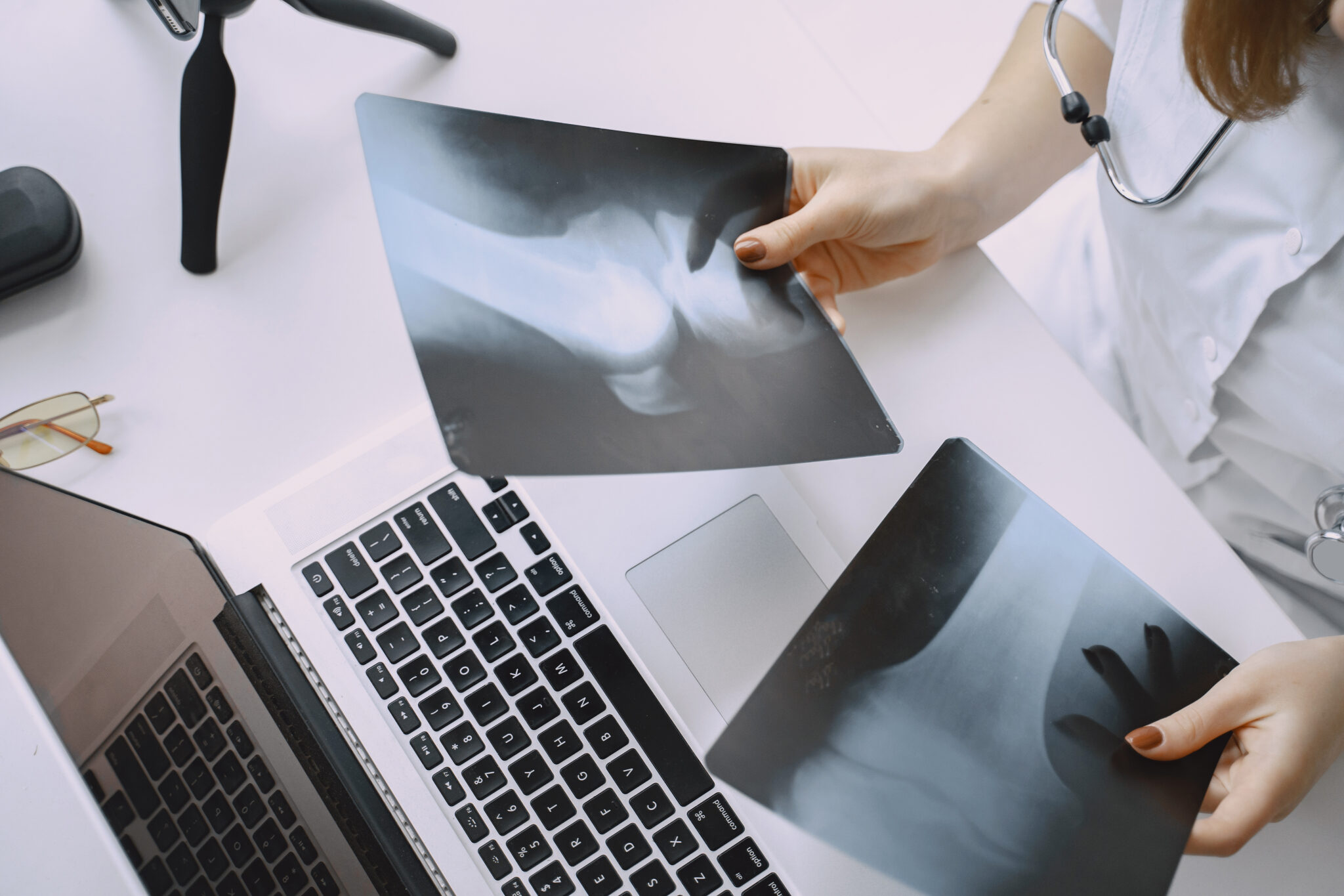Rheumatoid Arthritis: What Is, Causes, Diagnosis, and Treatment