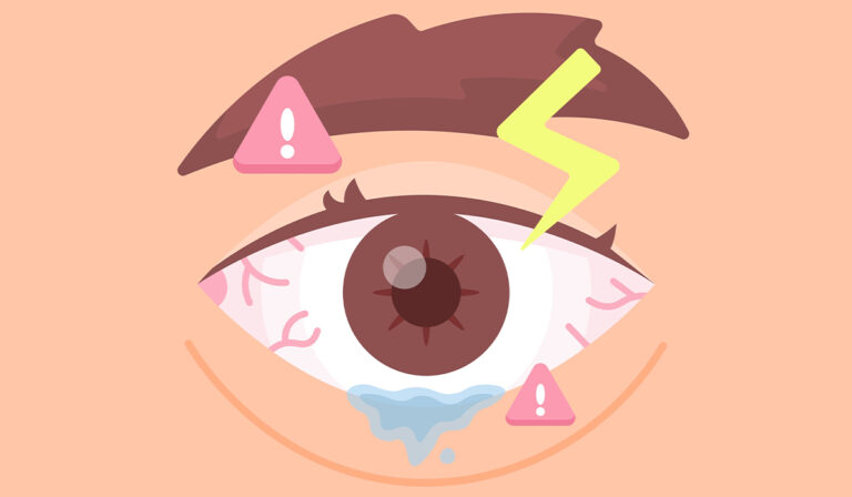 Blurry Vision: What Is, Causes, Diagnosis, and Treatment